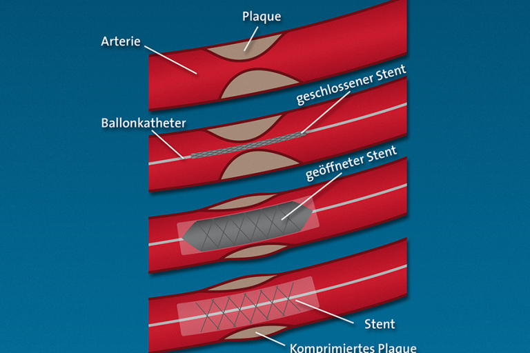 Angiologie – Kardiologisch-Angiologische Praxis